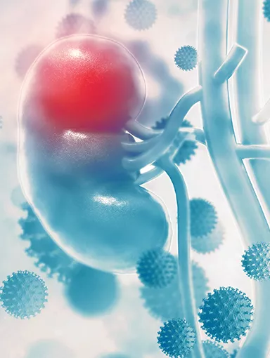 Kidney Failure | What are Chronic Kidney Disease Symptoms?